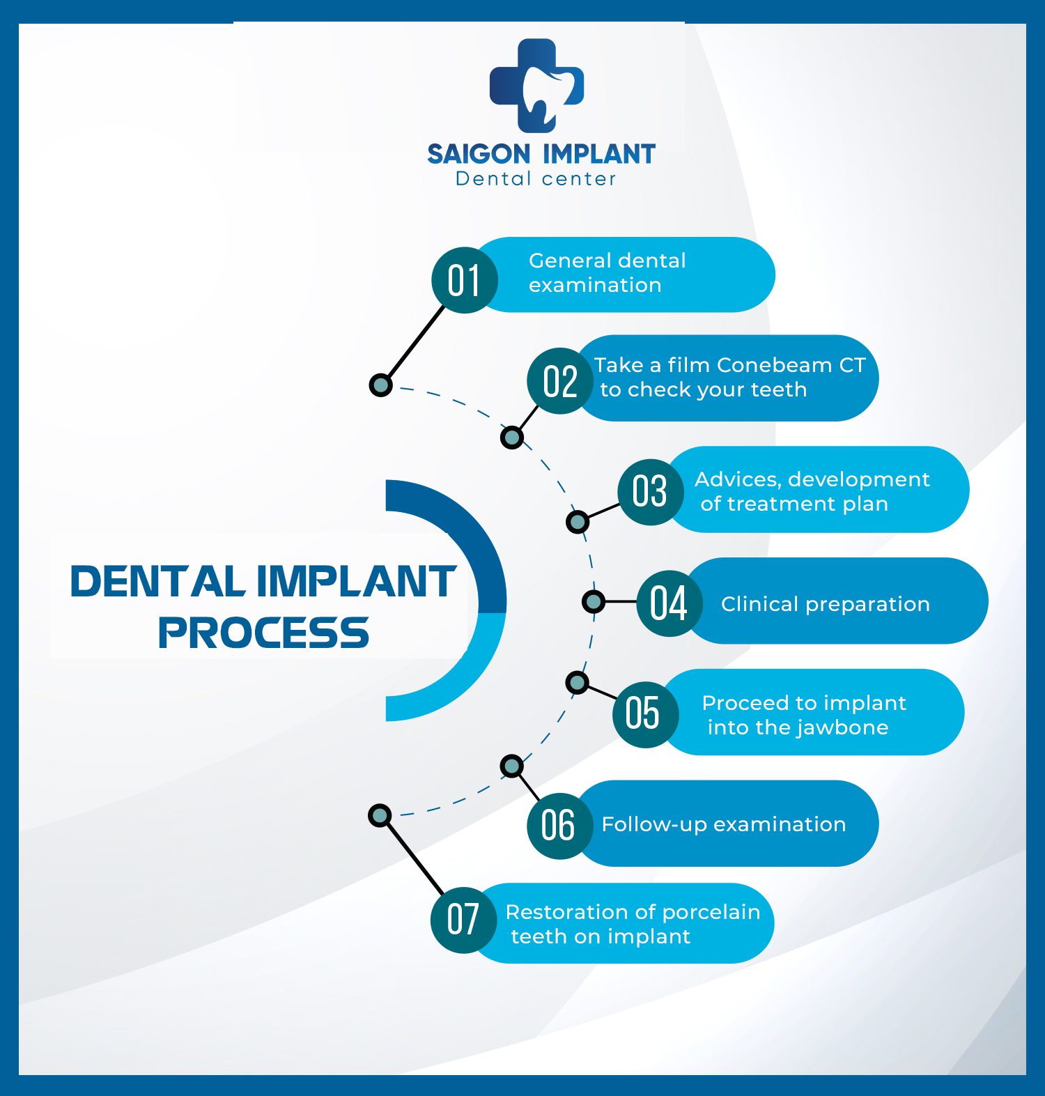 SINGLE IMPLANT AT SAIGON IMPLANT DENTAL CLINIC - Saigon Implant Dental Clinic - All On 4 In Vietnam