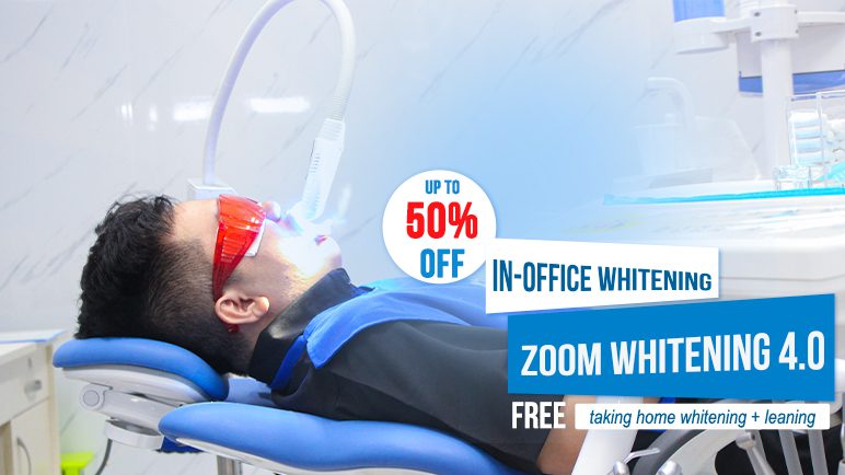 Teeth Whitening: Professional Process and Cost - Saigon Implant Dental ...