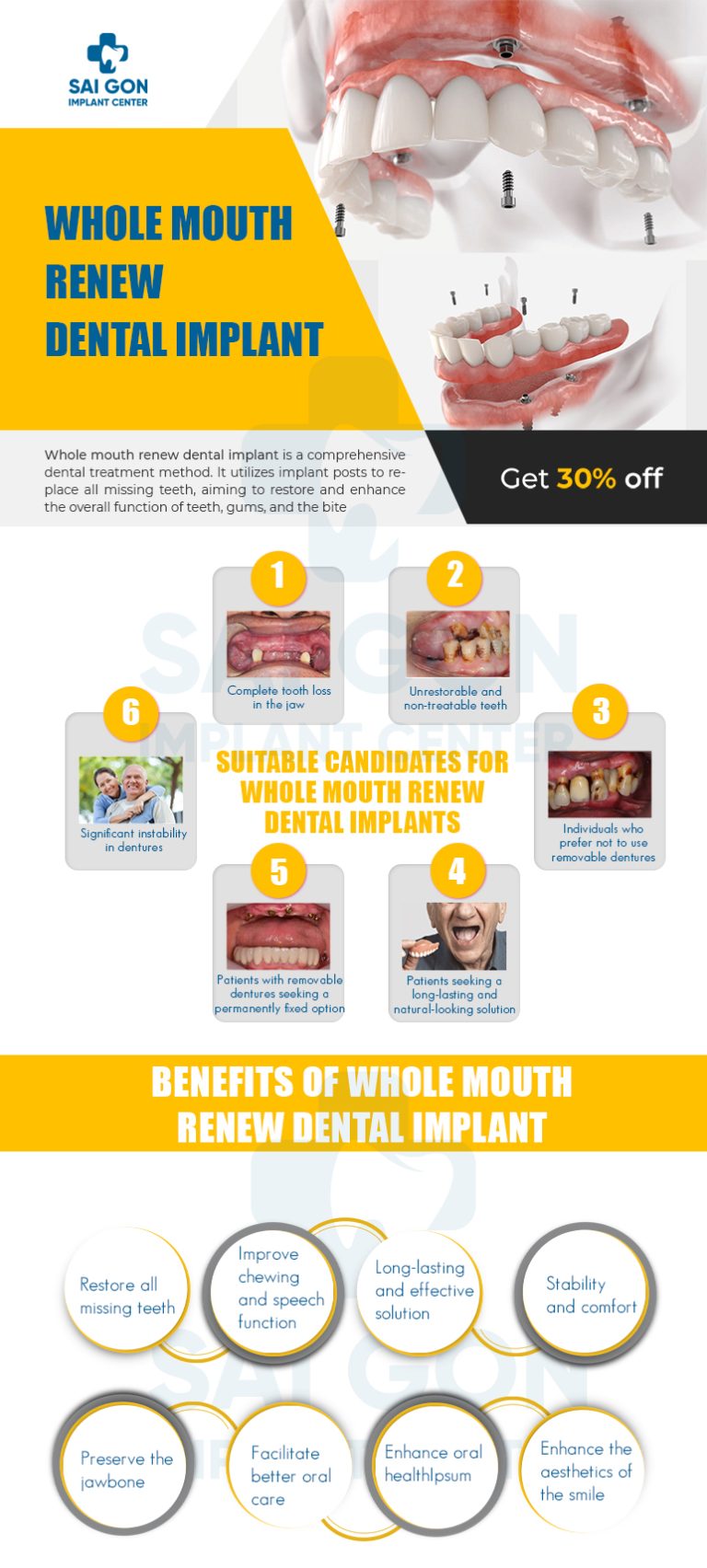 Whole Mouth Renew Dental Implants In Just 1 Day In Vietnam | SAIGON ...