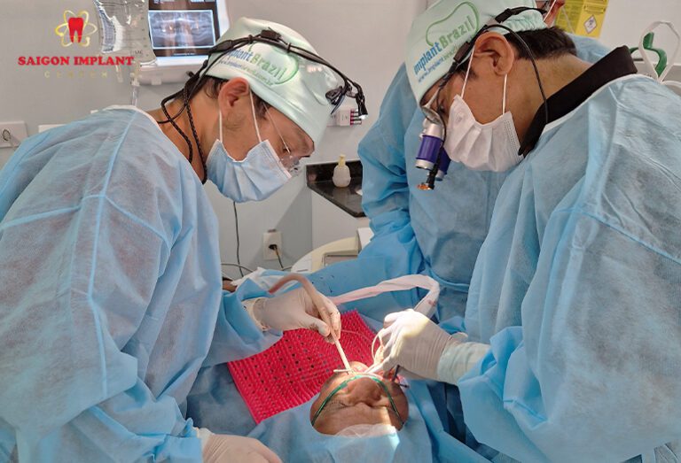 What Is A Basal Implant? A Complete Guide | SAIGON IMPLANT CENTER