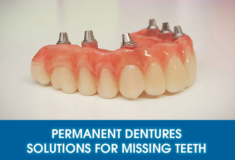 Are upper denture implants safe? | SAIGON IMPLANT CENTER
